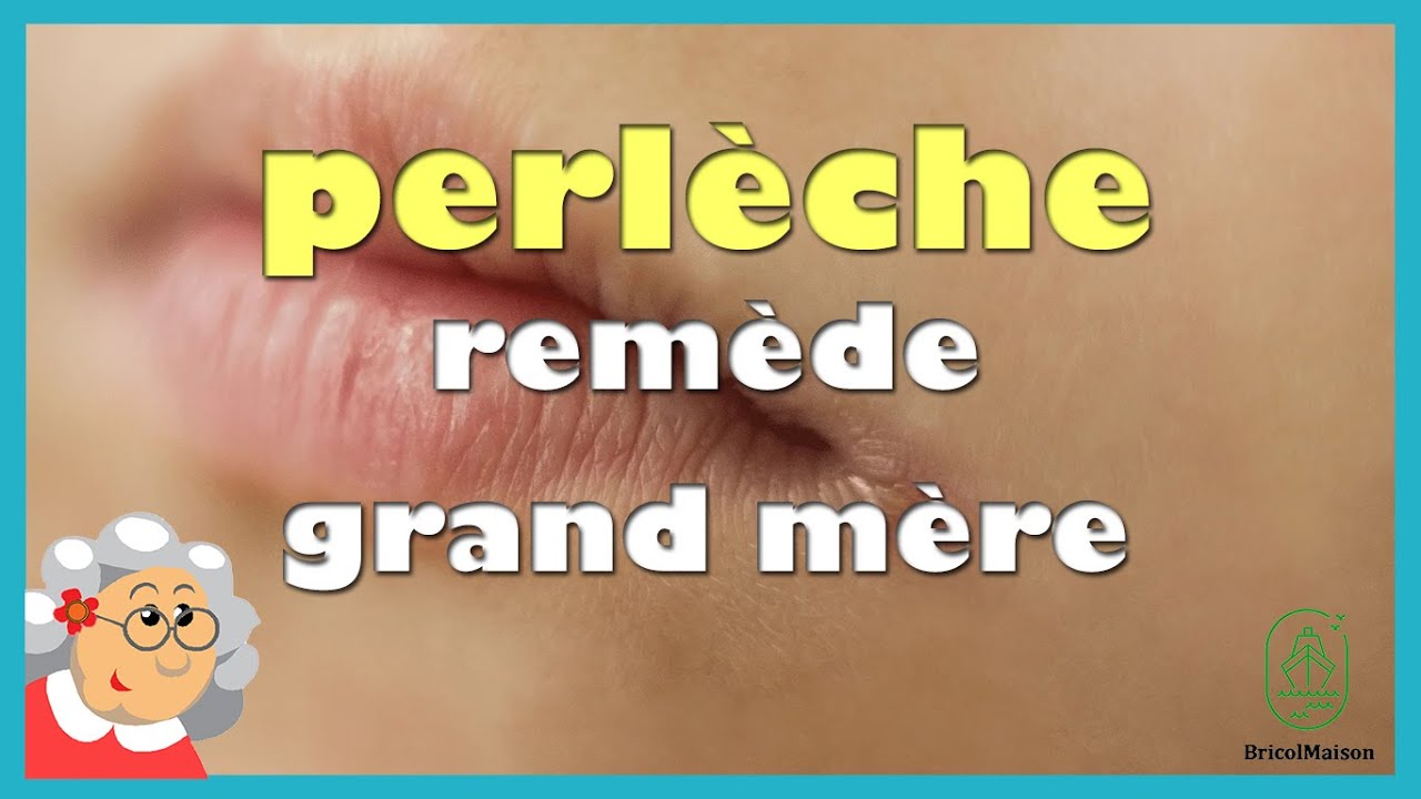 Perlèche remède grand mère - YouTube
