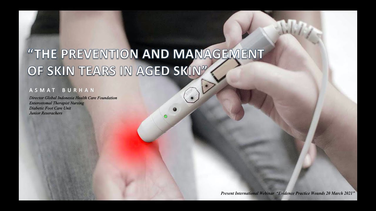 INTERWEB #S6 NURSING SKIN TEARS MANAGEMENT DURING COVID-19 PANDEMIC ...
