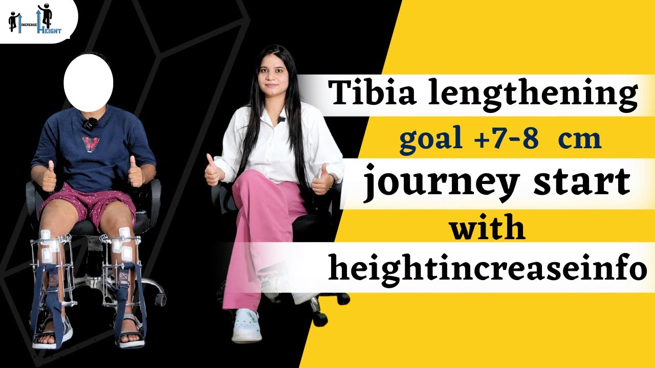 Tibia lengthening goal +7-8 cm Journey start With heightincreaseinfo ...