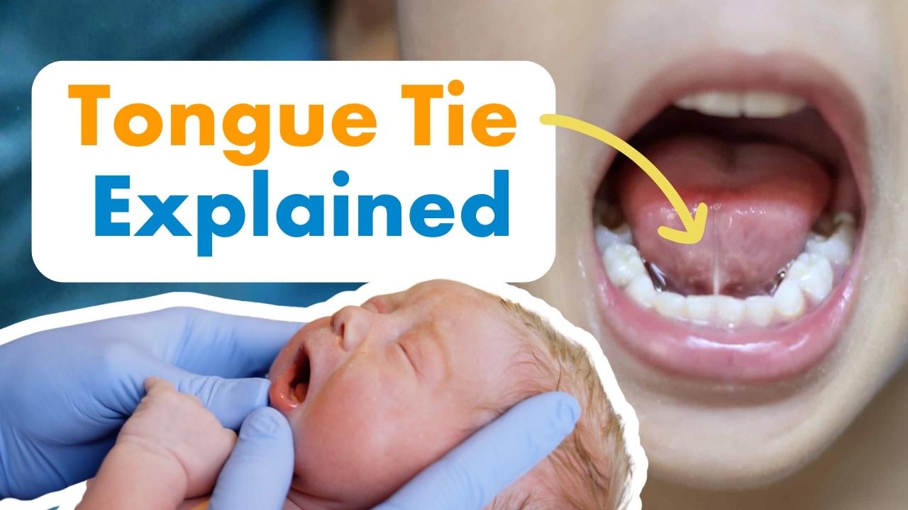 Tongue Tie in Kids: What Parents Need to Know - YouTube