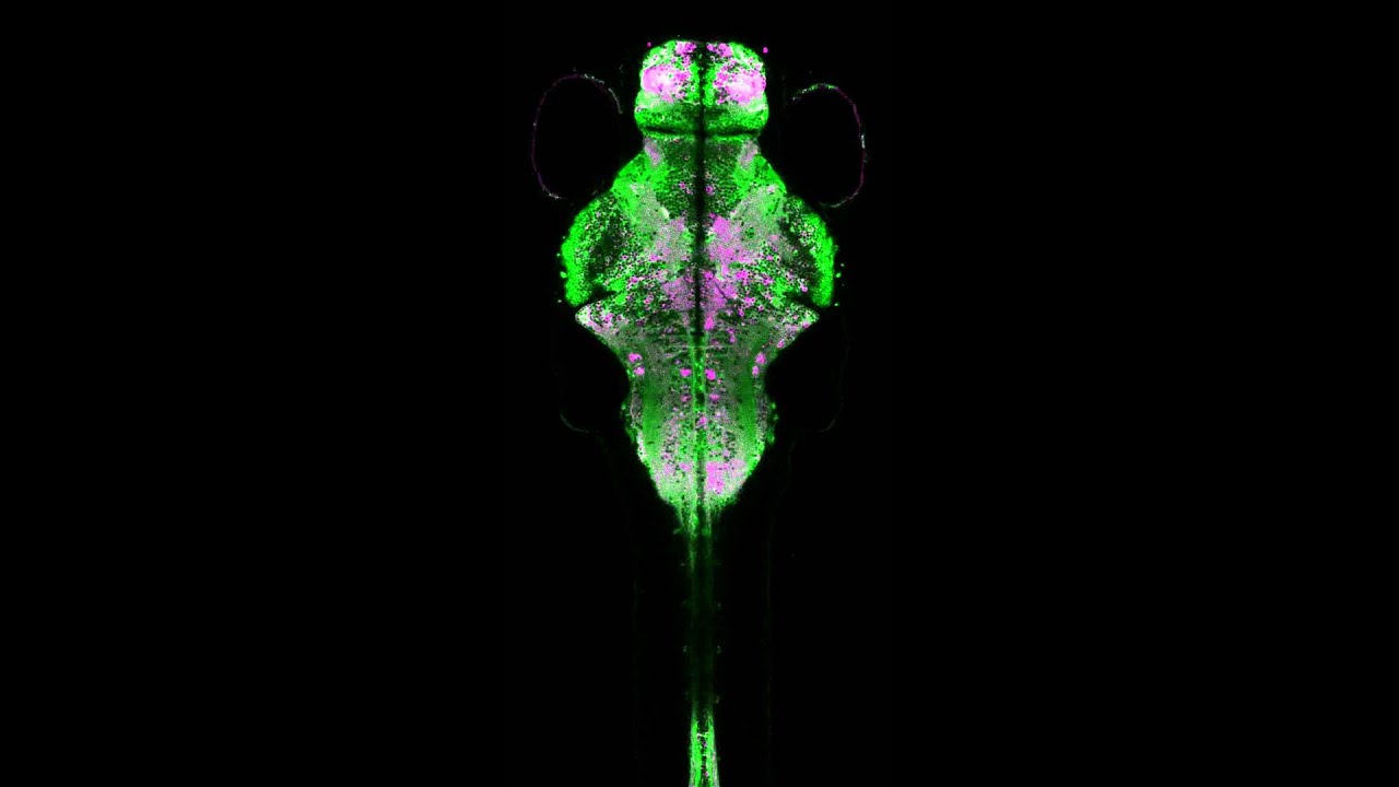 Zebrafish Brain Activity Captured Using New CaMPARI Red Fluorescent ...