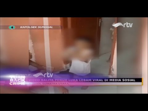 Dianiaya Paman dan Bibinya, Balita di Medan Alami Trauma