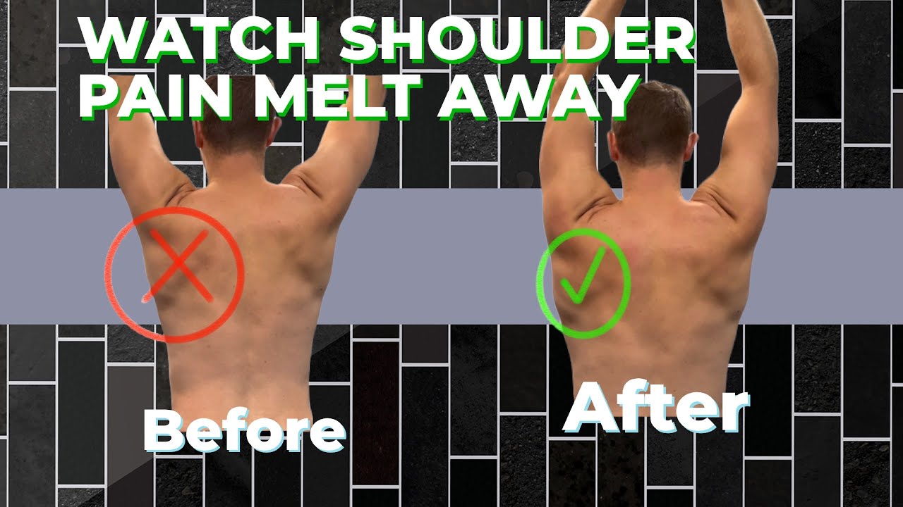 Chronic Shoulder Pain Resolved - YouTube