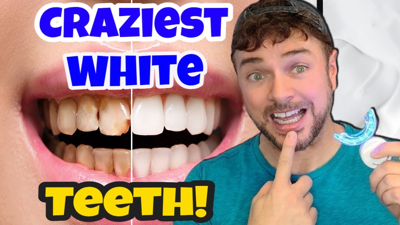 Get The CRAZIEST SUPER WHITE TEETH Fast | Chris Gibson - YouTube