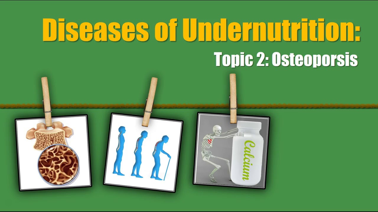 Nutrition - Undernutrition Diseases - YouTube