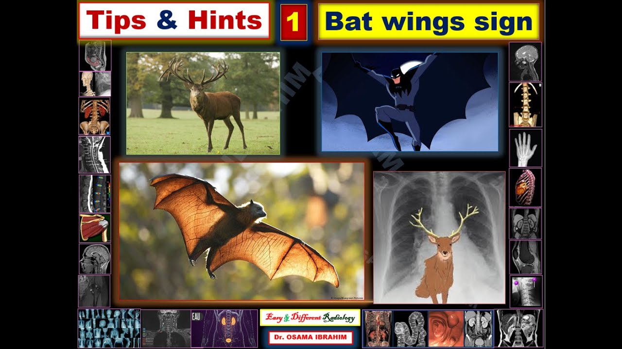 Tips & Hints (1) - Bat wings sign - YouTube