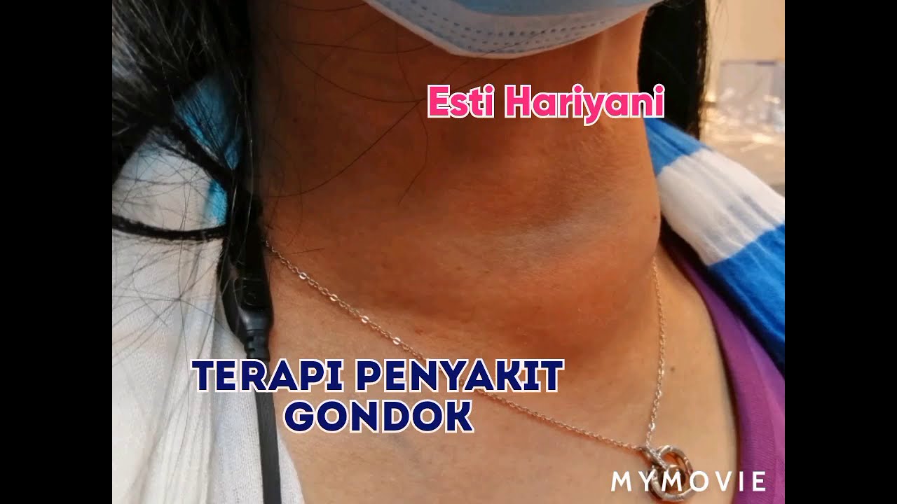 Terapi Gondok dengan Geometri dan Bio Light 3 | Doing therapy for ...