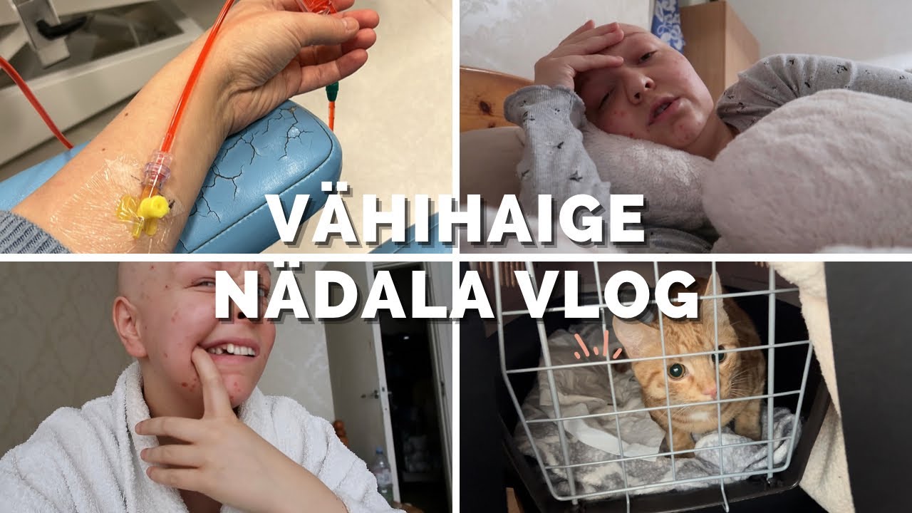 VLOG | Hammas tuli ära, proovin jumestuskreemi ja uus keemiaravim - YouTube