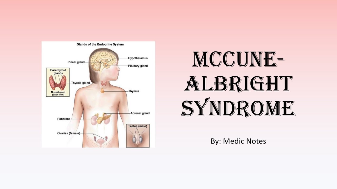 McCune-Albright syndrome - causes, genetic mutation, clinical presentation, investigation ...