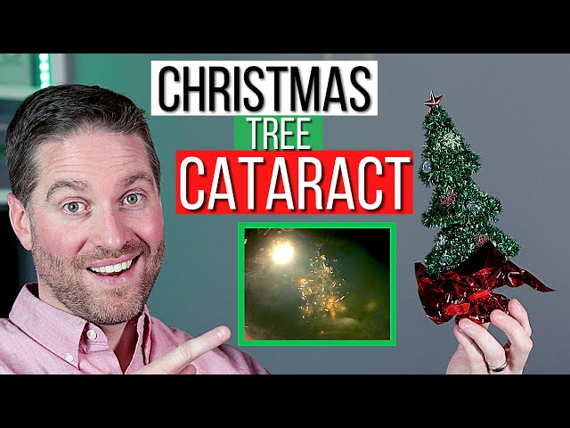 Christmas Tree Cataract Myotonic Dystrophy