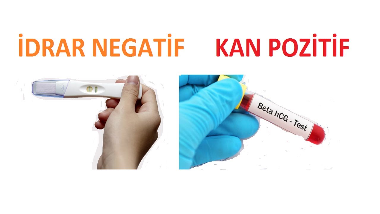 İDRAR TESTİ NEGATİF ÇIKIP HAMİLE OLAN VAR MI ? - YouTube
