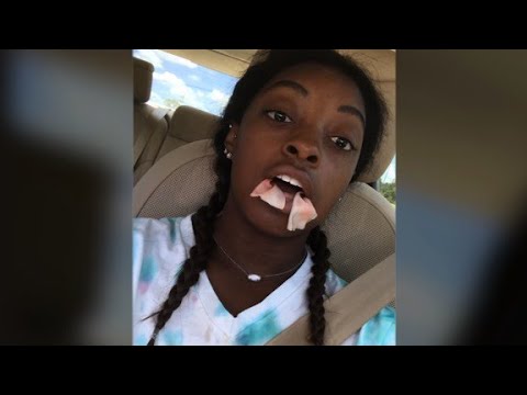 Simone Biles tweets dazed post-surgery video