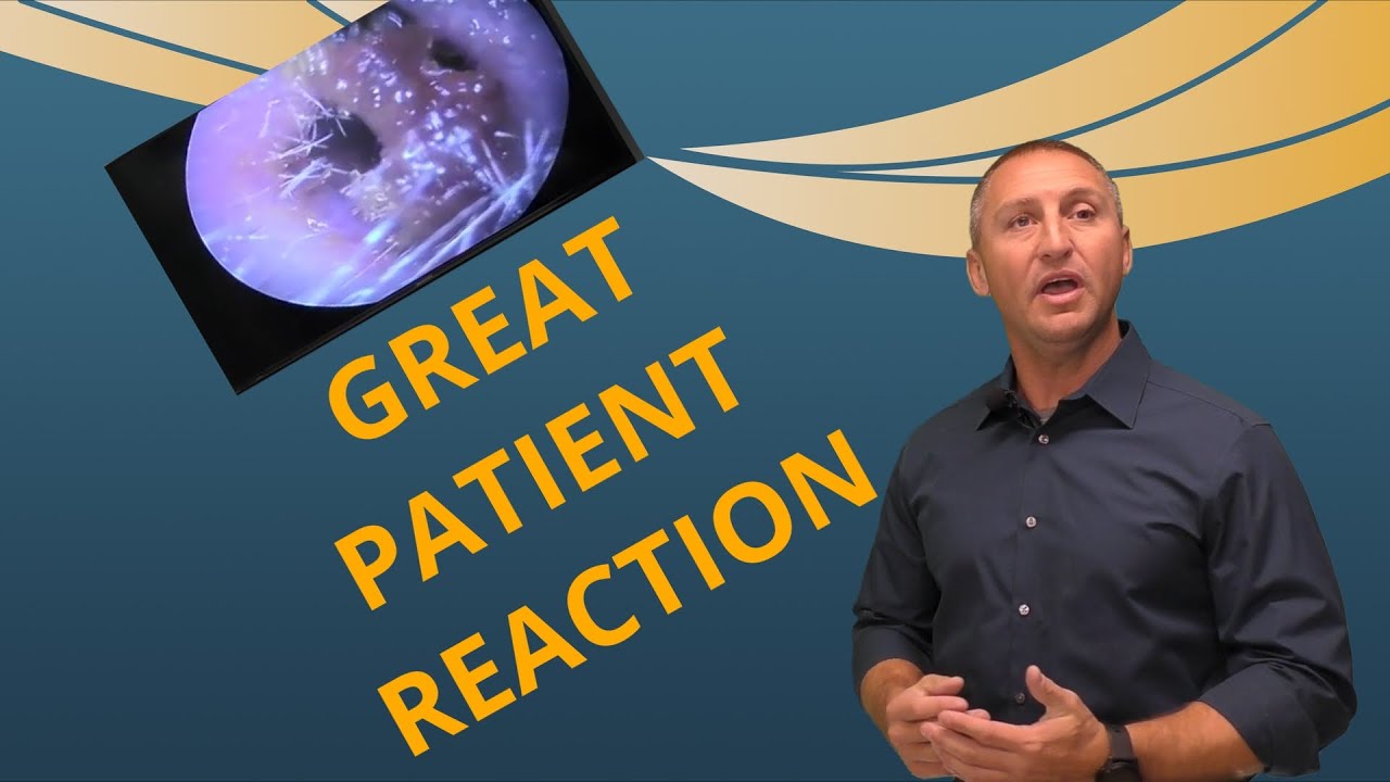 GREAT patient reaction - Wax removal - YouTube