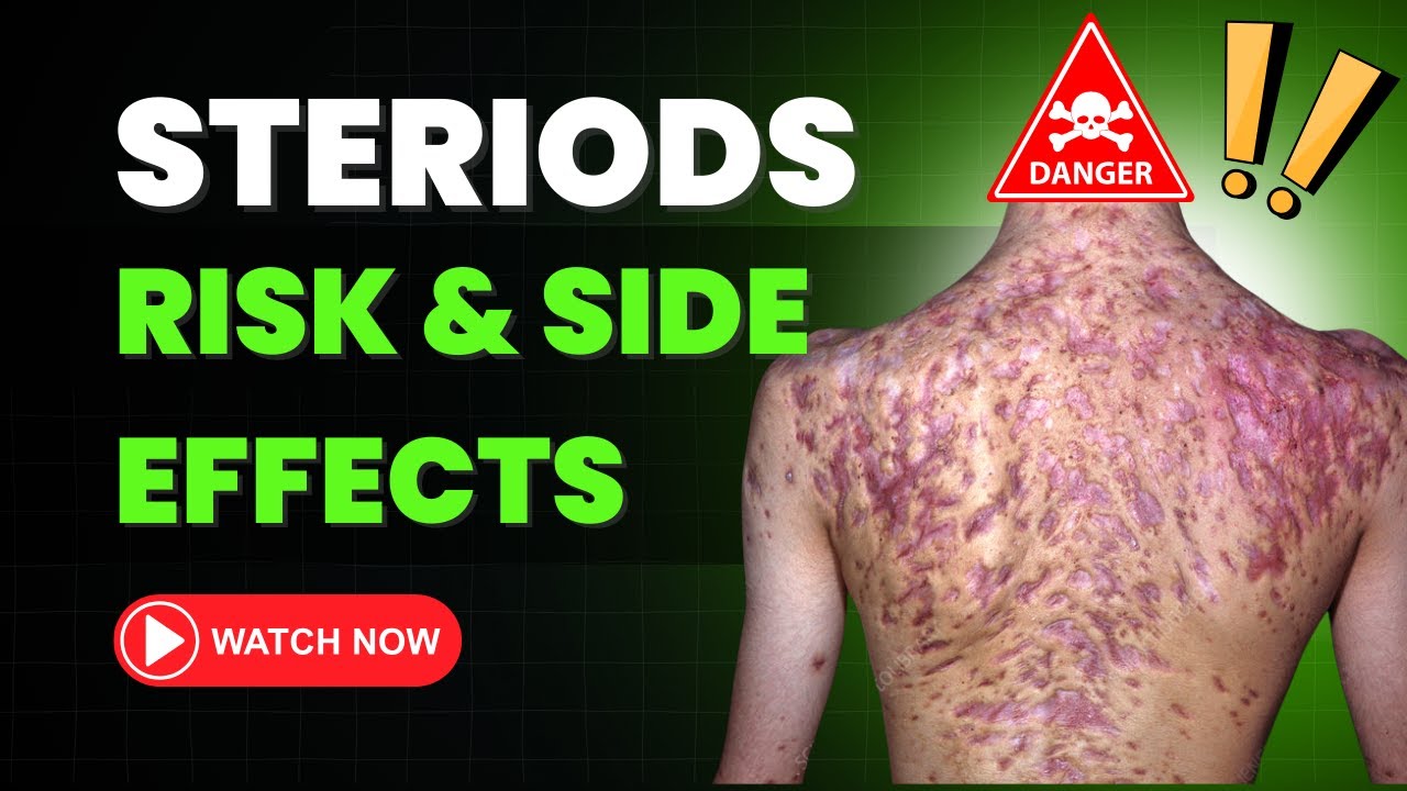Steroid's Side Effects & Risk For Bodybuilders In Hindi 2025 - YouTube