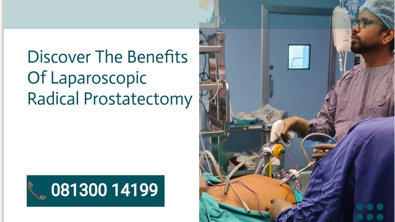 Laparoscopic Radical Prostatectomy. How I do it.. Simplified. step by ...