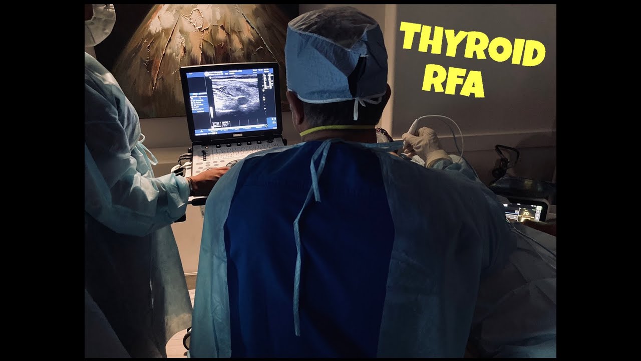 Thyroid Radio frequency ablation (RFA) of by Sean Nikravan MD - YouTube