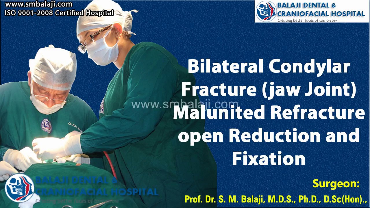 Bilateral Condylar Fracture (jaw Joint) Malunited Refracture open ...