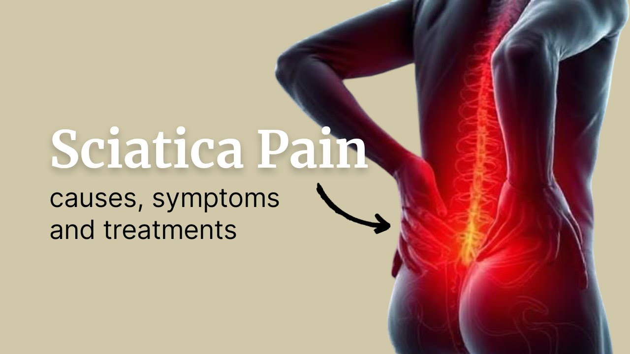 Sciatica Pain - Causes, Symptoms and treatments (Explained) - YouTube