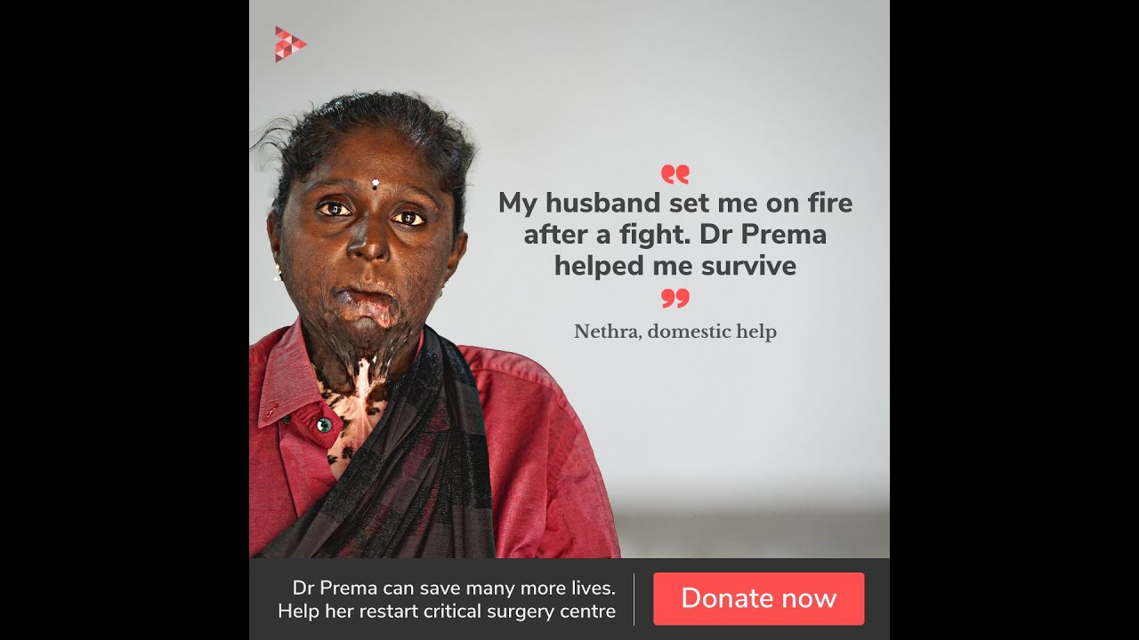 Help Dr Prema Dhanraj help burn victims with surgery and care - YouTube