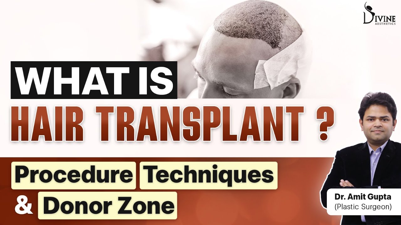 What is Hair Transplant: Procedure, Techniques & Donor Zone | Dr Amit Gupta - YouTube