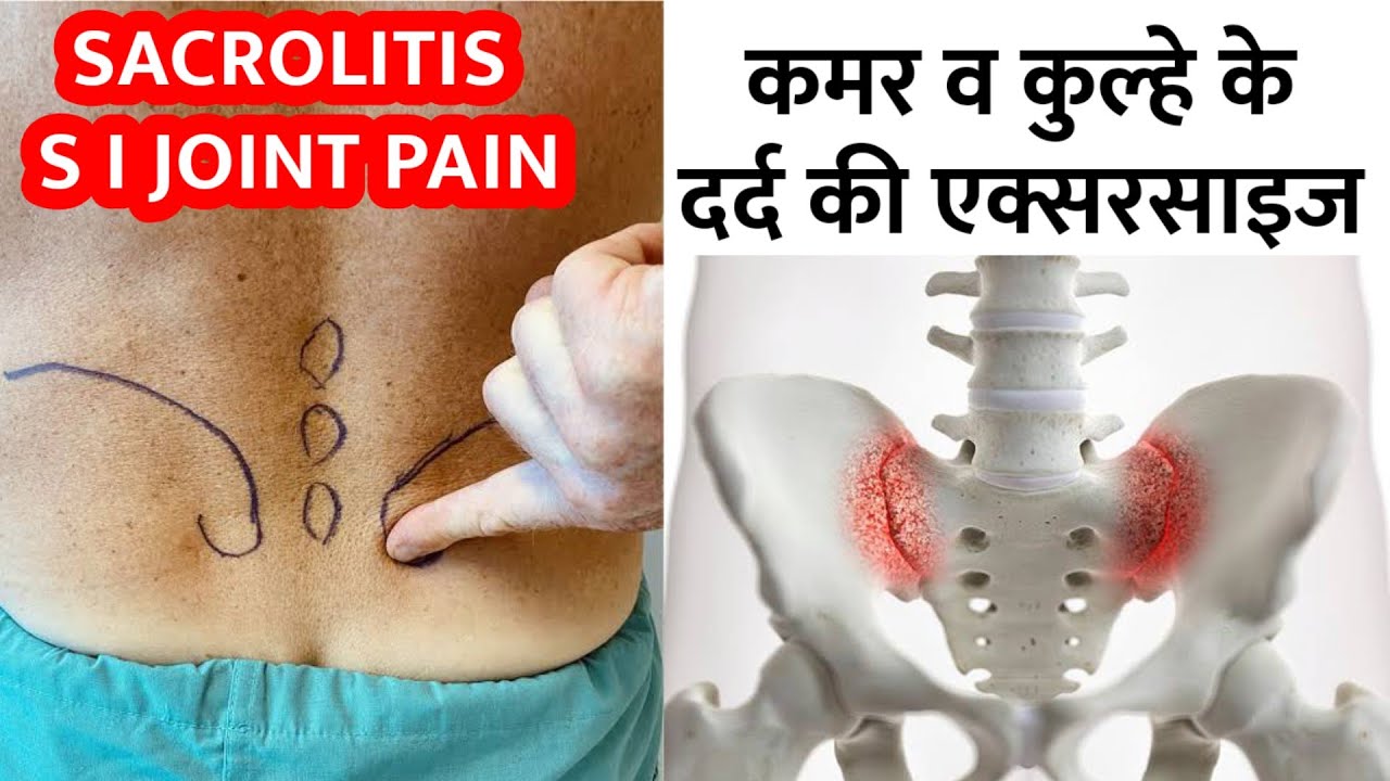 Sacroiliac Joint Pain Exercises | कमर व कूल्हे के दर्द का इलाज ...