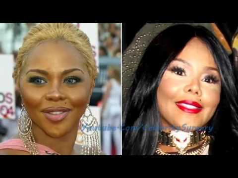 Lil Kim Before and After Plastic Surgery - YouTube