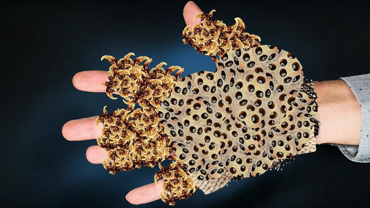 ASMR Remove Maggots & Worm Infected Hand | ASMR Treatment | Severely ...