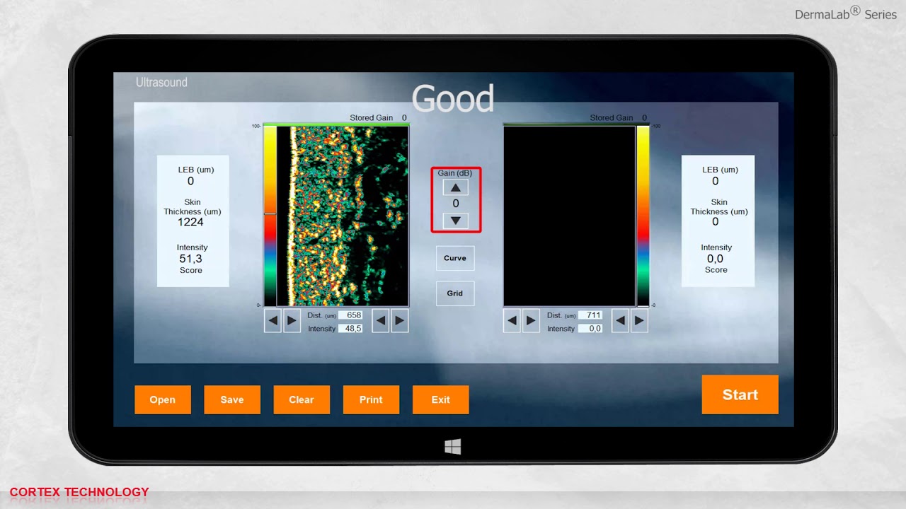 DermaLab Skin Ultrasound Probe - YouTube