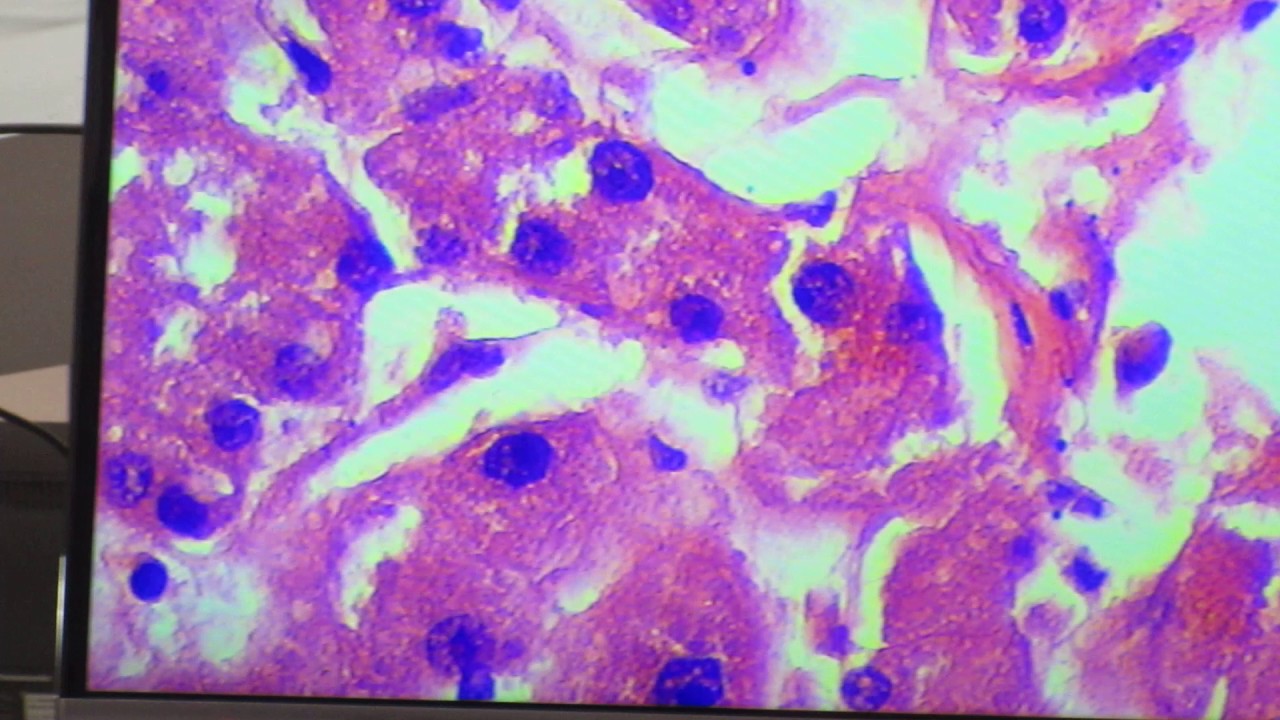 CELULA DE KUPFFER HIGADO HISTOLOGIA - YouTube