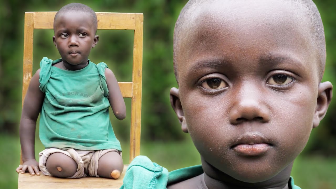 The Unstoppable Spirit of Our Girl Born Without Legs and an Arm : BORN ...