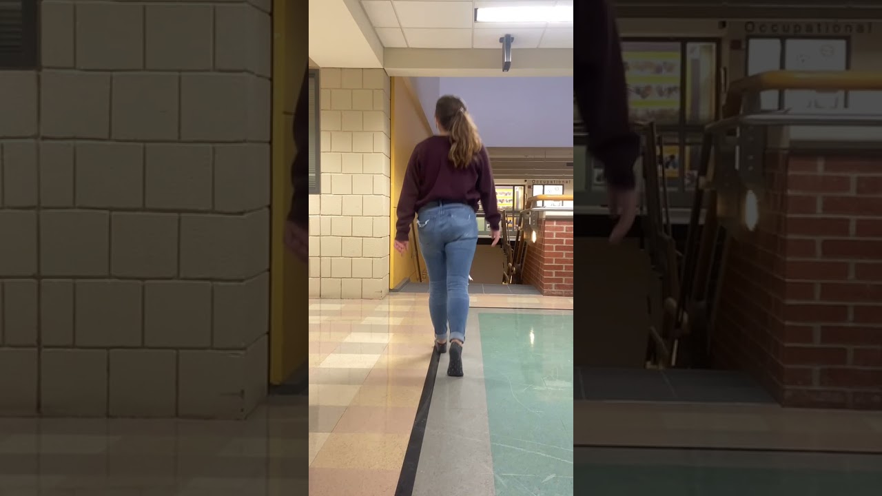 Vaulting gait frontal view - YouTube