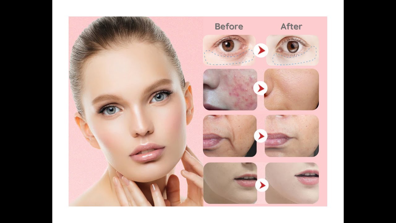 7 in 1 Skin Savior The Ultimate Rejuvenation Device! - YouTube