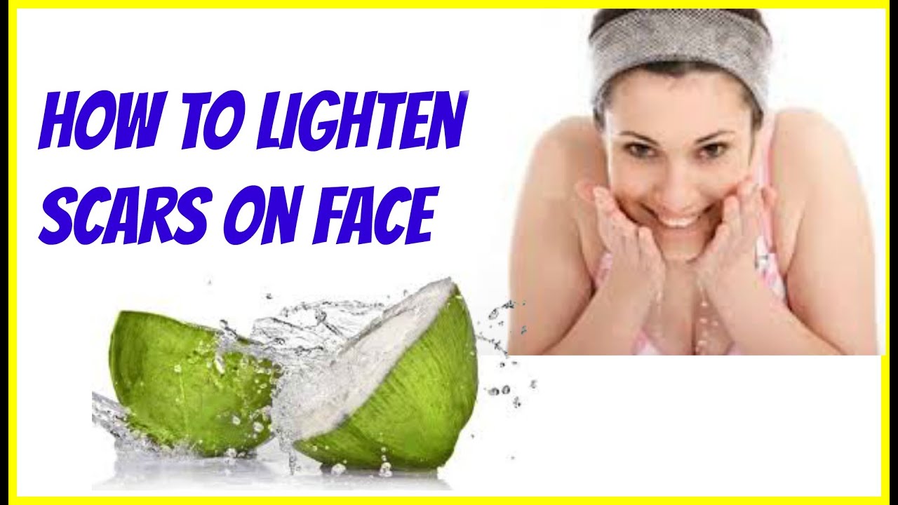 DIY Beauty Tips Tricks How To Lighten Scars On Face YouTube diy-beauty-tips-tricks-how-to-lighten-scars-on-face-youtube
