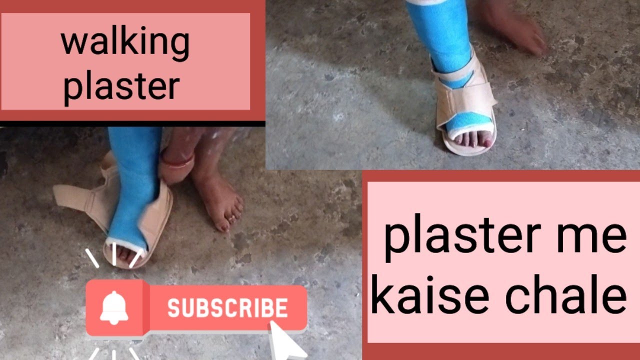 plaster ke sath kaise chale # plaster shoes #vlogger #dailyvlog - YouTube