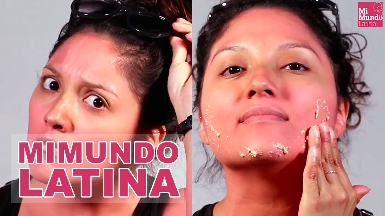 ¿Cómo eliminar el ardor por quemadura de sol? - YouTube