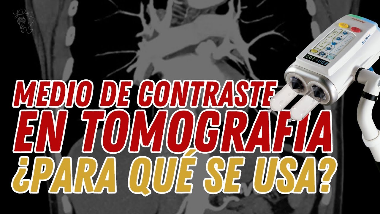 TOMOGRAFIA Y MEDIOS DE CONTRASTE 🤔😰 ☢🩺💡 #radiologia #TC - YouTube