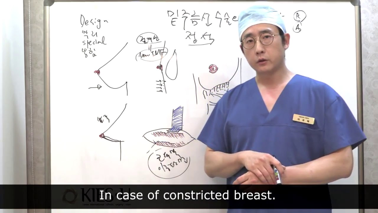 Breast augmentation Korea(inframammary fold incision) 강남가슴성형전문 밑주름선절개 ...