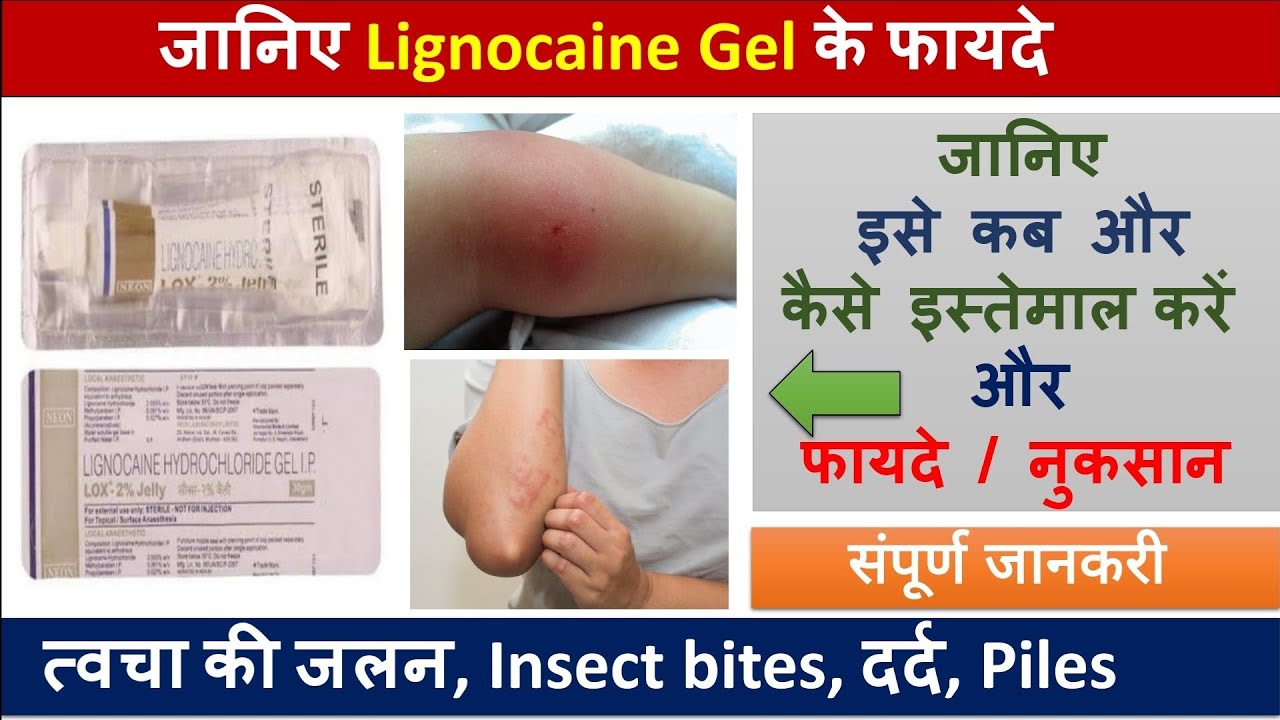 Lignocaine Gel Uses, Side Effects, Dosage, Precautions, Price # ...