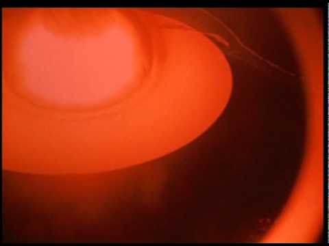 Atomic bomb - Castle Bravo - YouTube