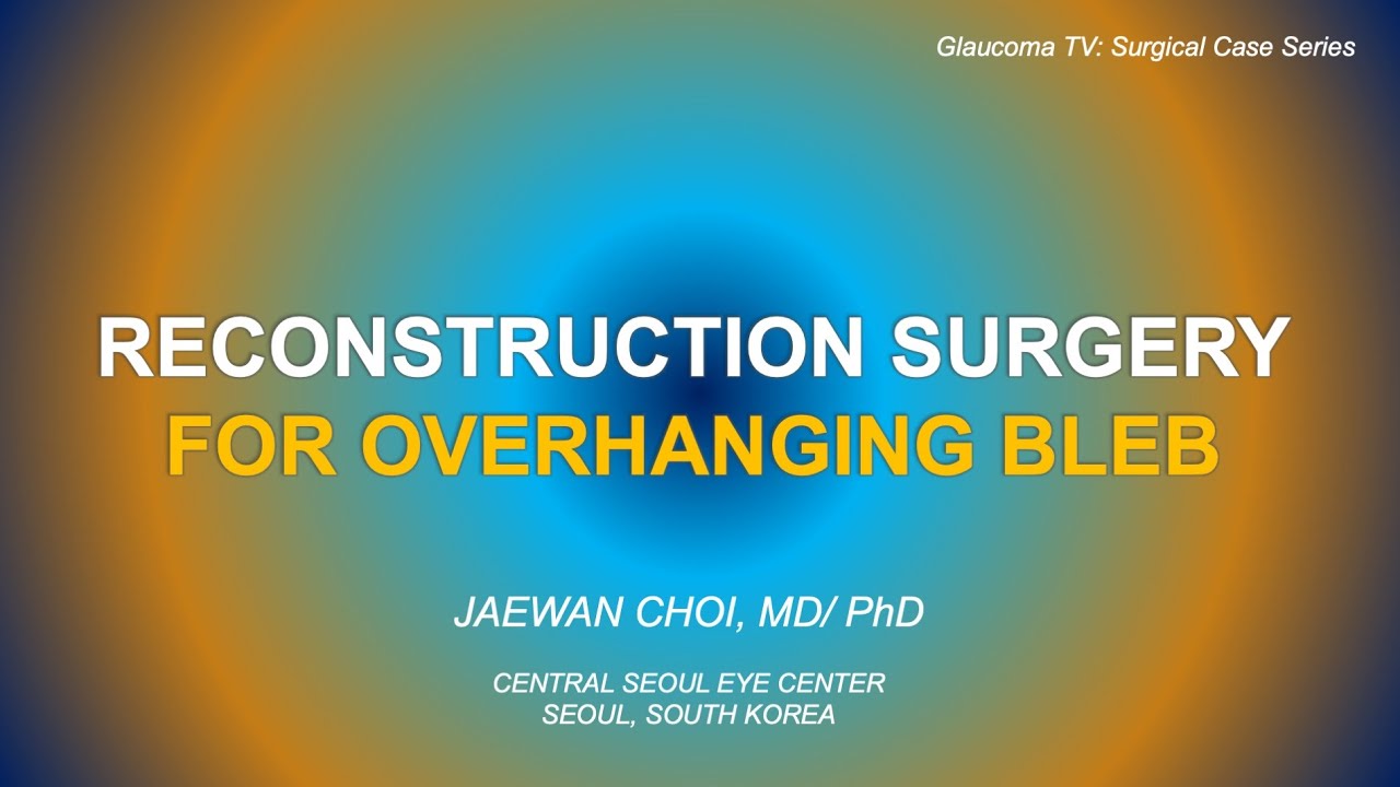 Reconstruction surgery for overhanging bleb - YouTube