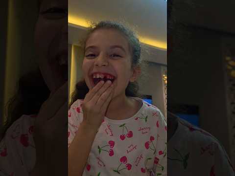 Elif kendi dişini kendi çekti!! #poyrazelif #keşfet #shorst