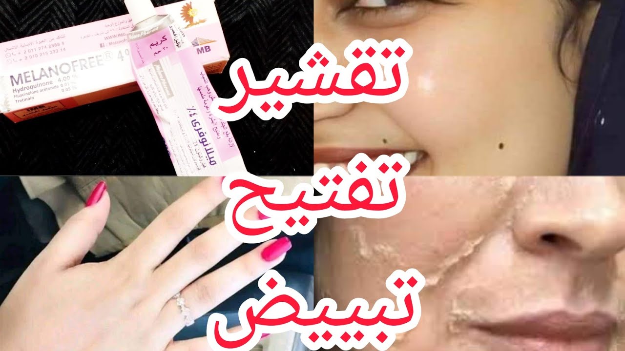 كريم ميلانو فري للتفتيح/كريم melano free للكف وحب الشباب وتقشير وتبييض ...