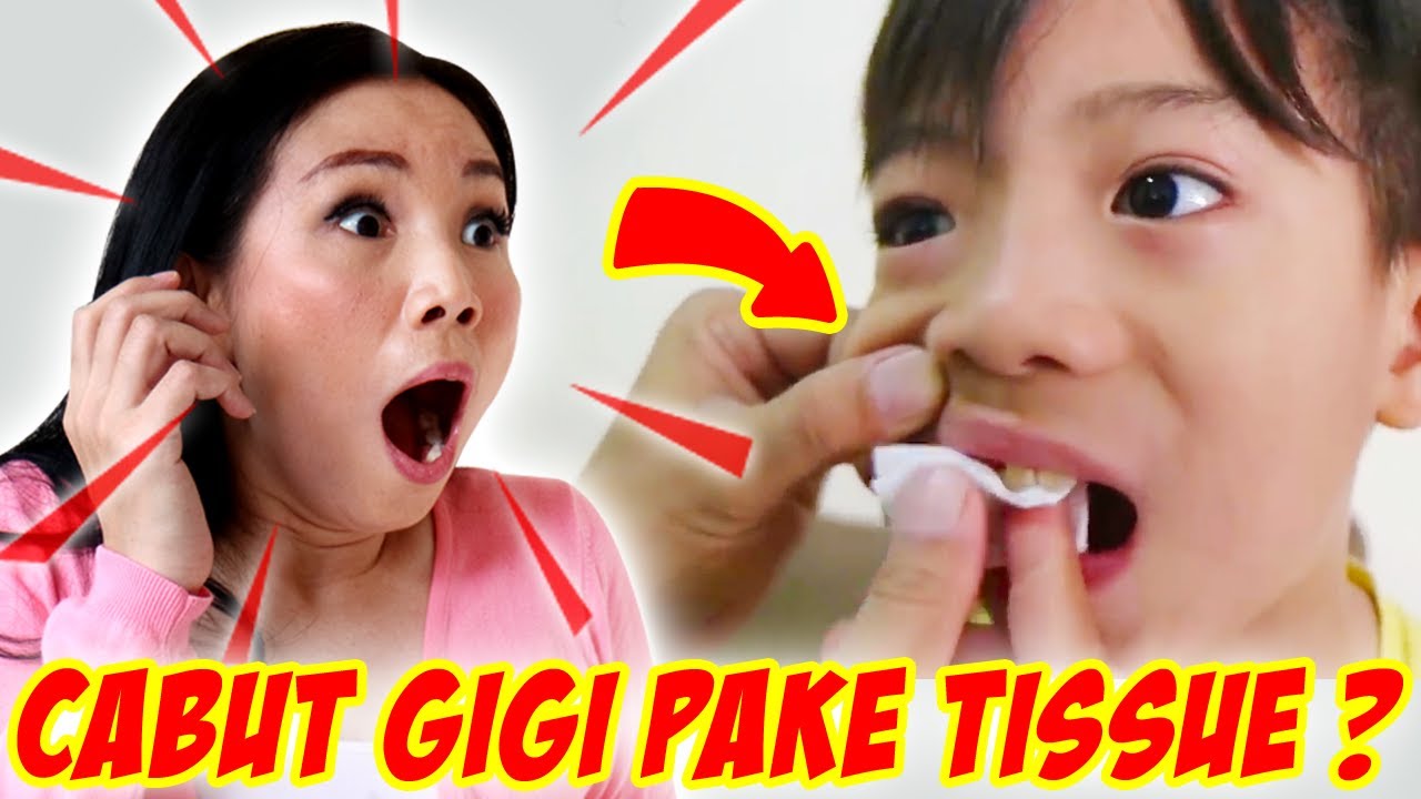 Xavier Cabut Gigi Modal Tissue ? Tanpa ke Dokter Gigi Kids Dentist ...