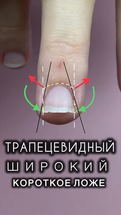 ТАКИХ НЕ БЕРУТ НА МАНИКЮР😬 #shortsvideo #аленалаврентьева # ...
