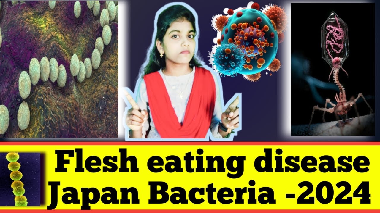 Deadly Flesh🍖eating Disease -Japan bacteria 🦠2024🤯Definition, Incidence ...