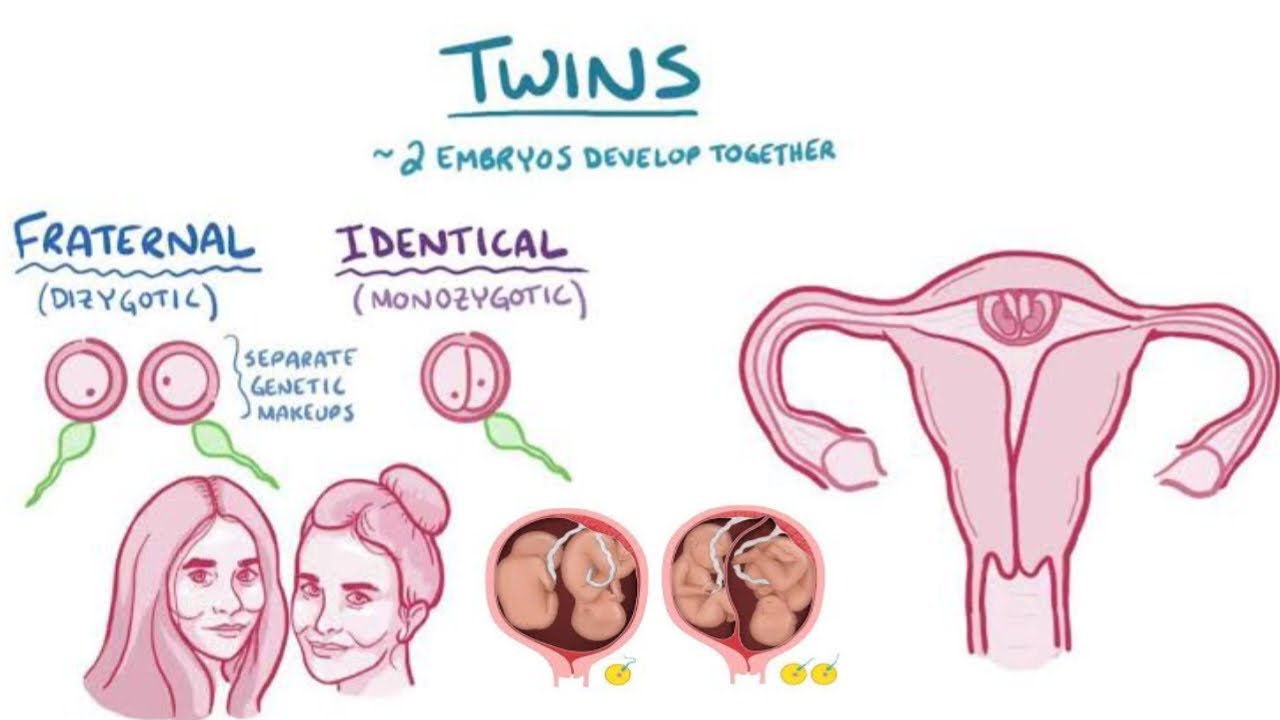 Twins pregnancy development and how it occur| conception|wisdom ...