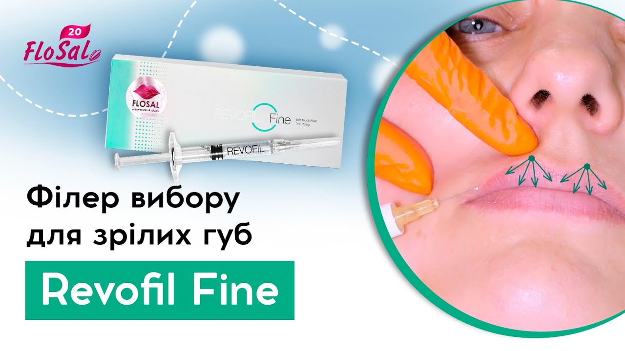 Аугментація зрілих губ💋 філером Revofil Fine - YouTube
