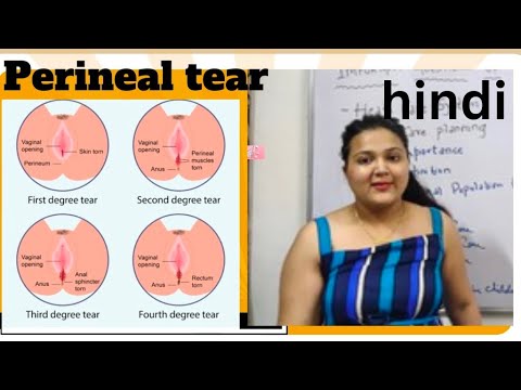 perineal trauma || perineal tear || degrees || management|| hindi - YouTube