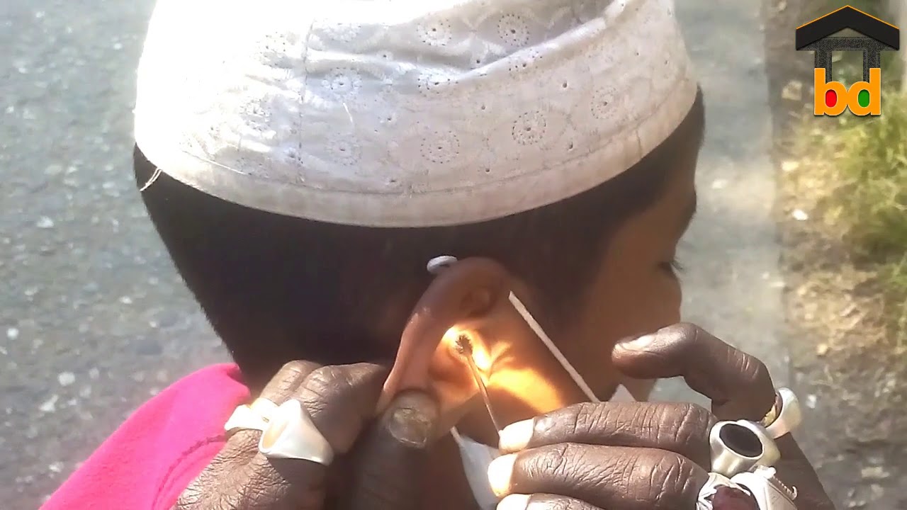[Latest] Ear Cleaning by Roadside Ear Cleaner II Chunky White Earwax ...