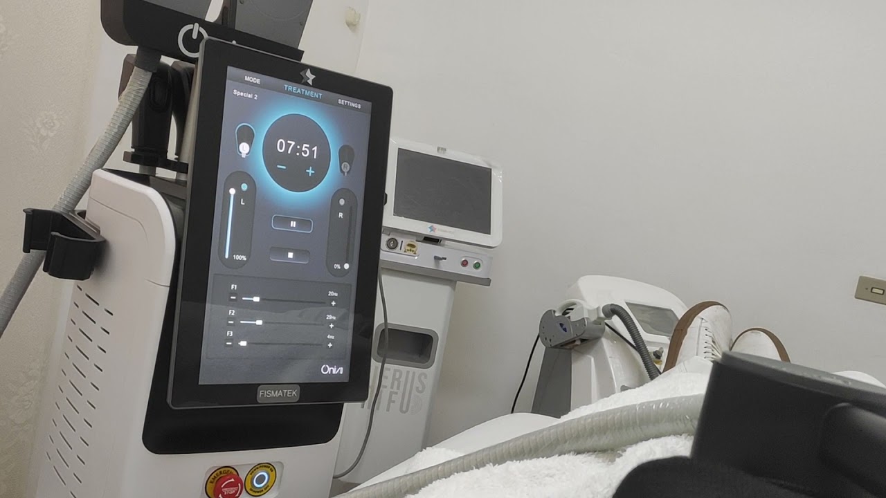 Ônix HIFEM (High Intensity Focused Electromagnetic) - YouTube